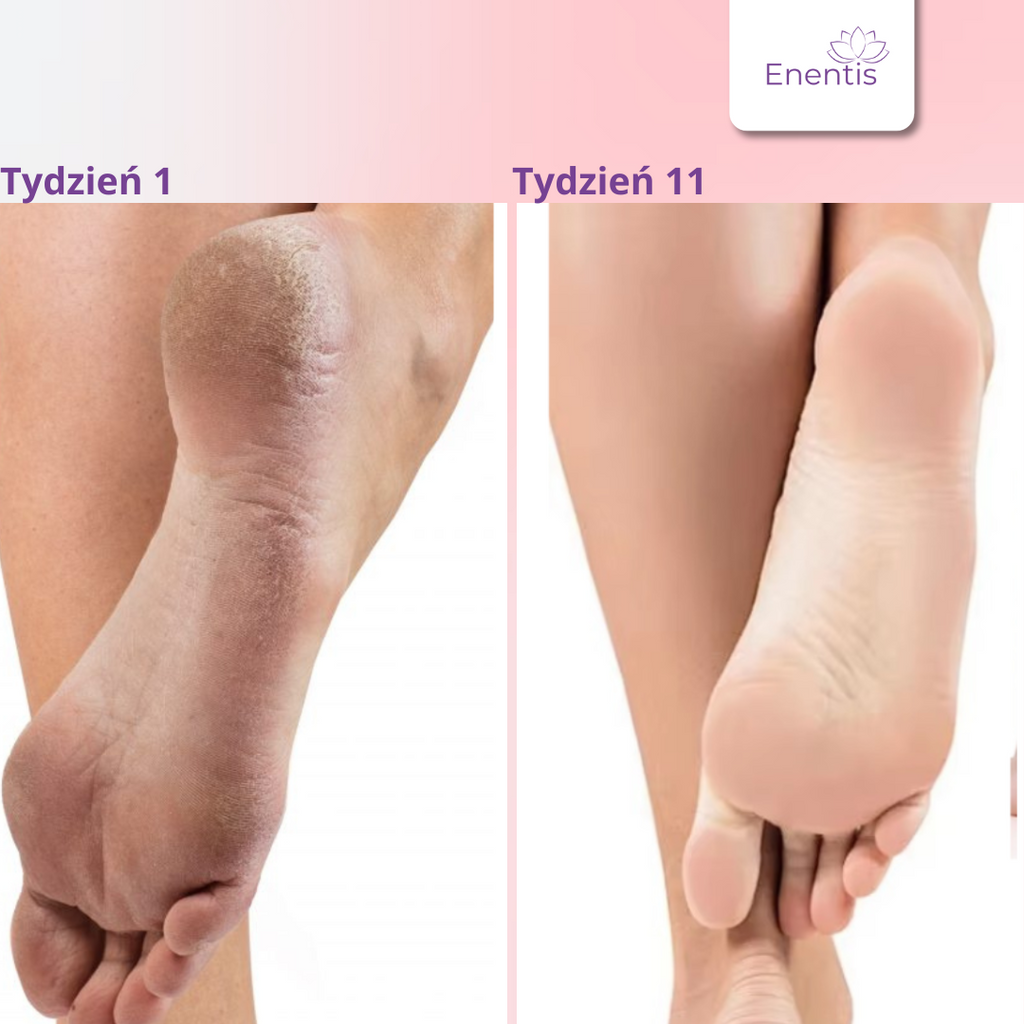 Skarpetki GlowFeet - zdrowe i nawilżone stopy od pierwszego użycia – Enentis