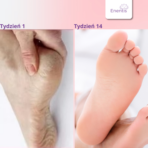 Skarpetki GlowFeet - zdrowe i nawilżone stopy od pierwszego użycia – Enentis